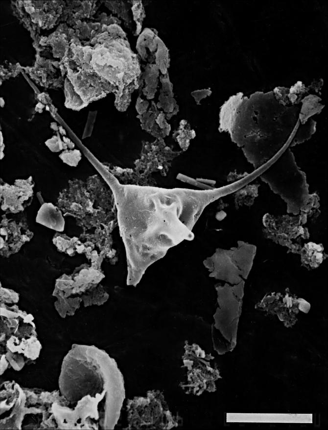 Veryhachium europaeum | Fossiilid.info