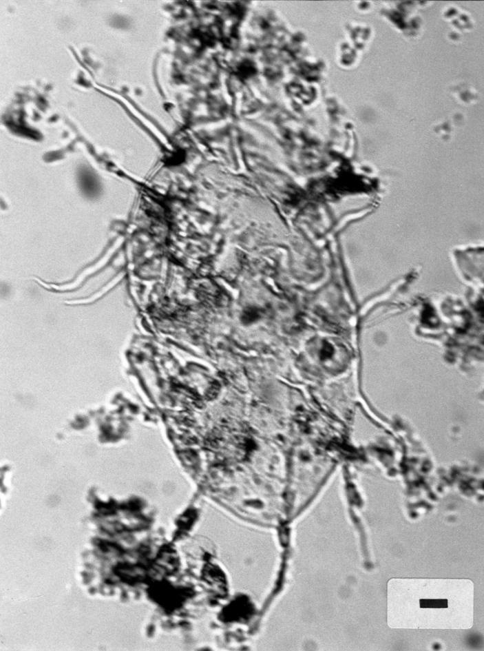 Acanthodiacrodium | Fossiilid.info
