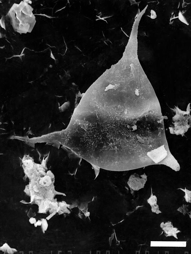 Veryhachium reductum | Fossiilid.info