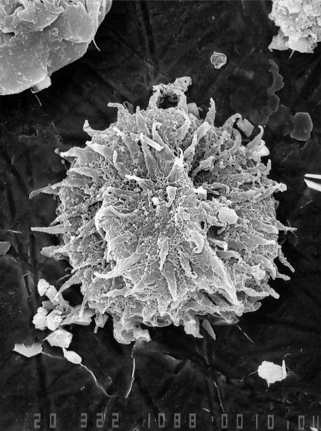 Dictyosphaeridium | Fossiilid.info