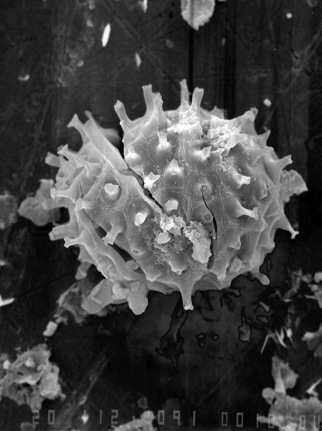 Lacunosphaeridium | Fossiilid.info