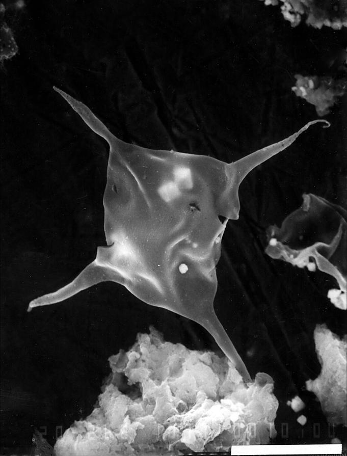 Veryhachium lairdi | Fossiilid.info