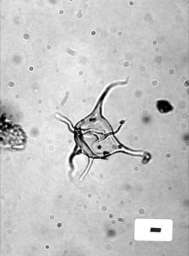 Veryhachium cymosum | Fossiilid.info