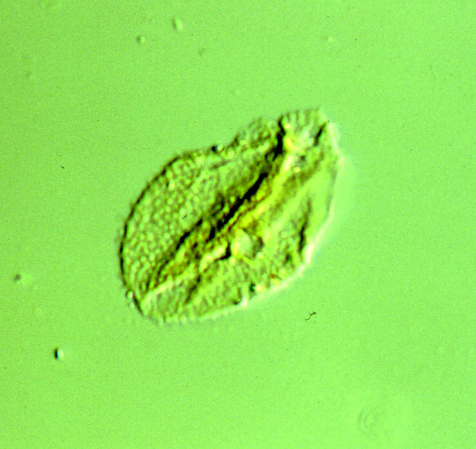 Lophosphaeridium latviense | Fossiilid.info