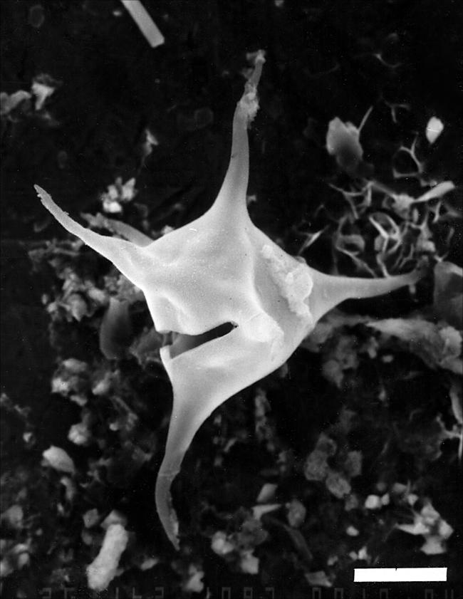 Veryhachium rhombispinosum | Fossiilid.info